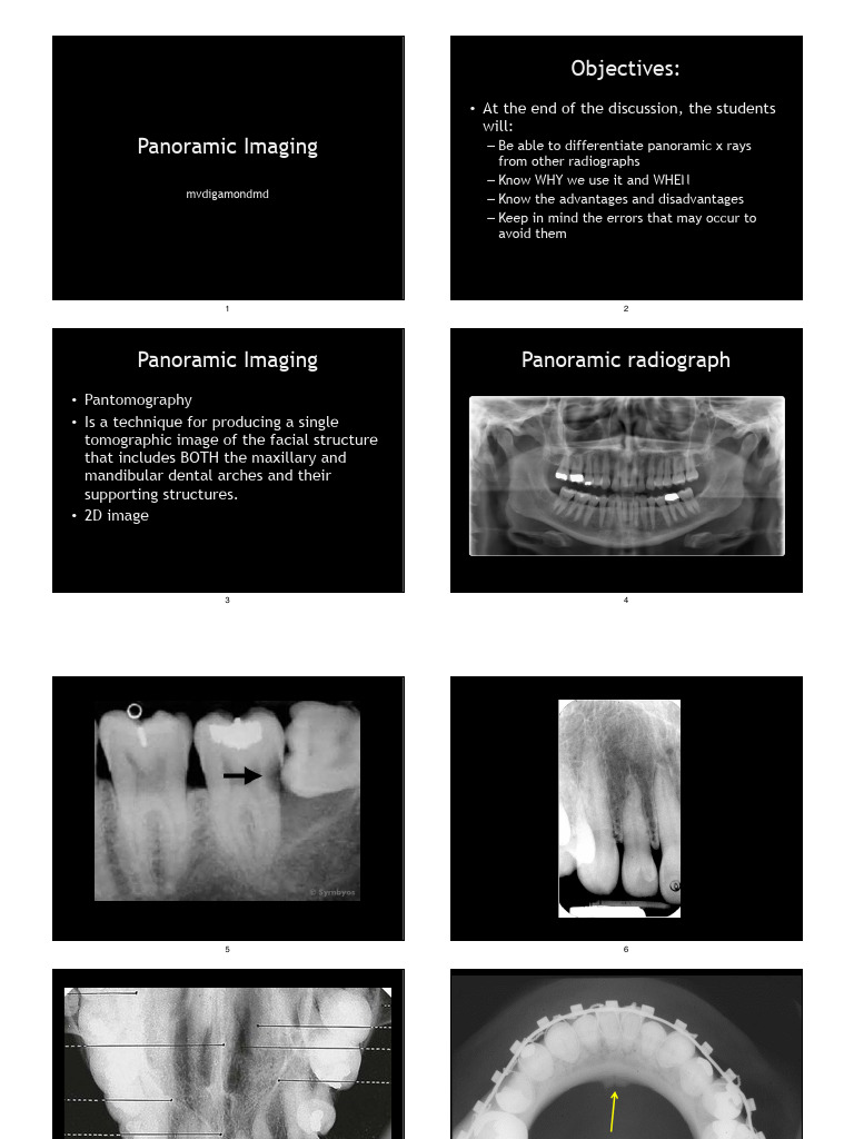 Panoramic Imaging Errors | PDF