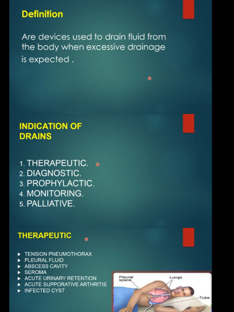 Surgical Drains | PDF