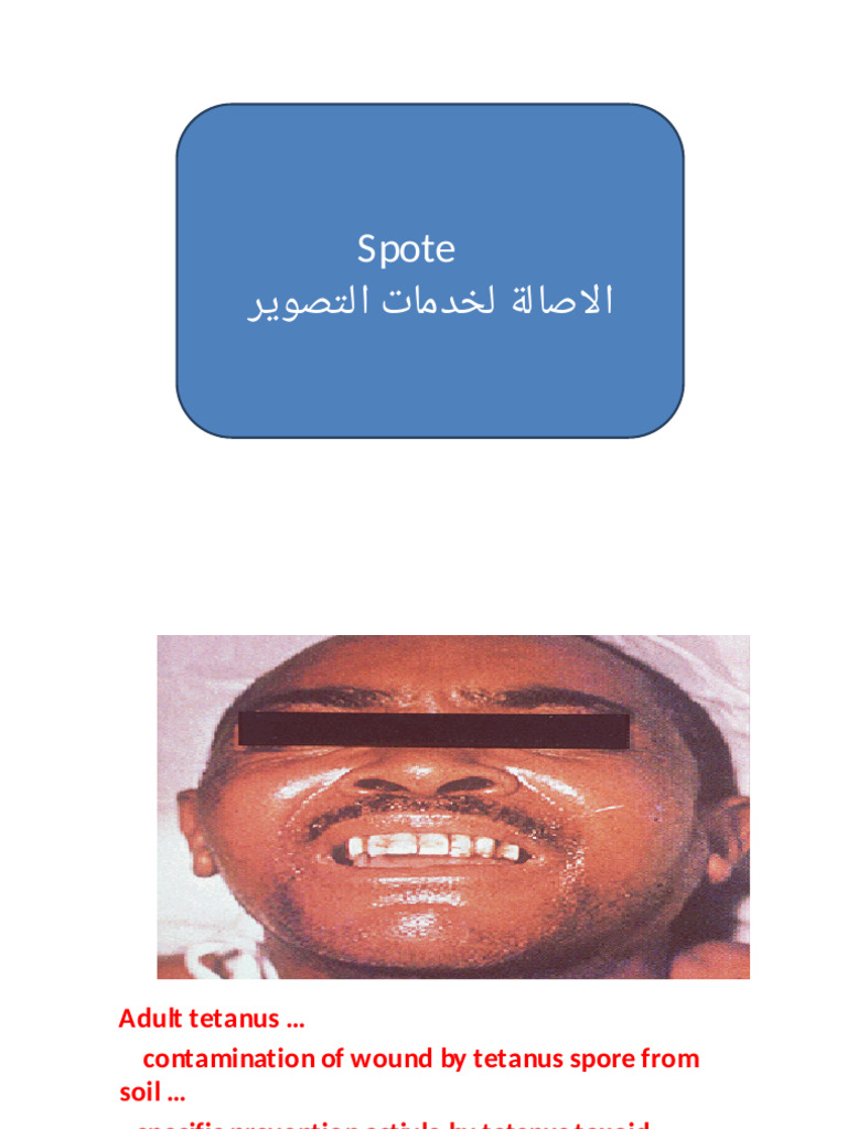 Spote PDF | PDF
