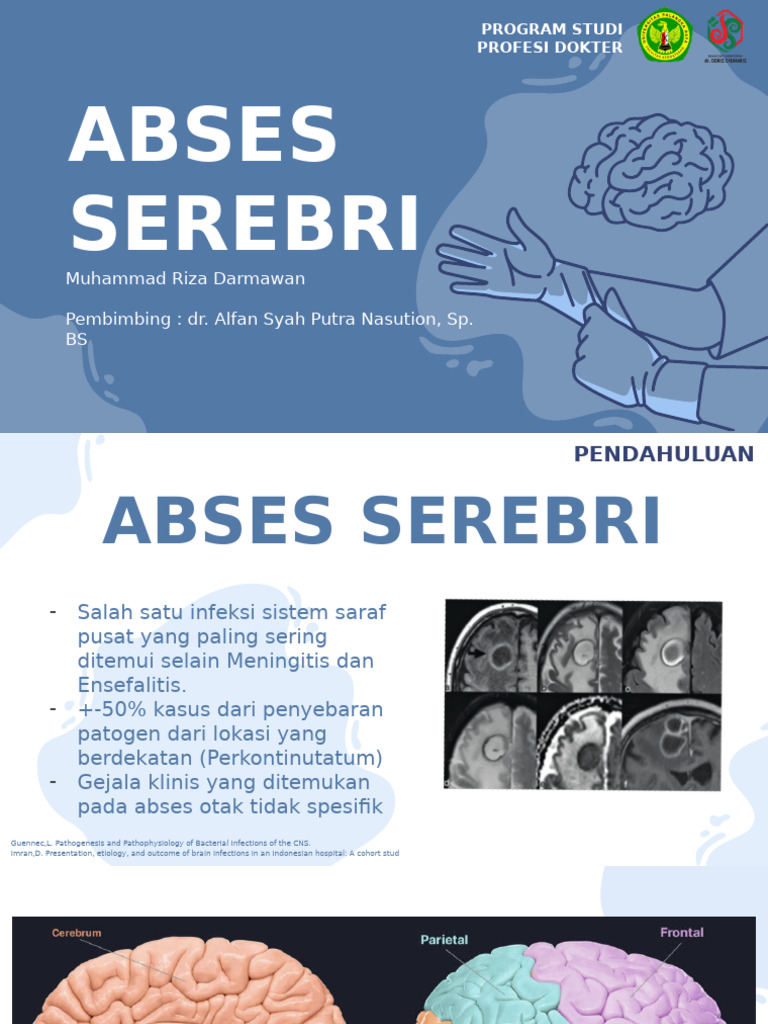 Referat Abses Cerebri Non PJB | PDF