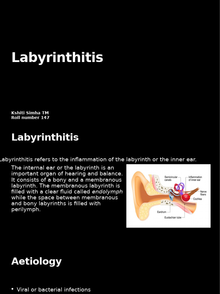 ENT - Labyrinthitis | PDF