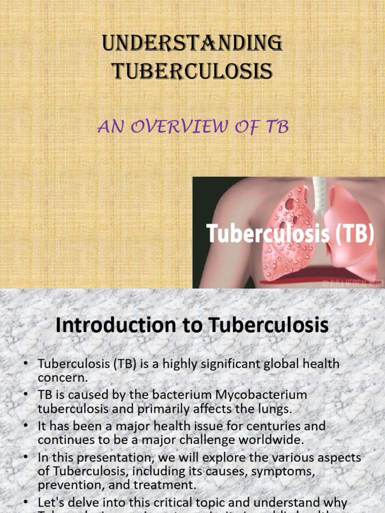 Understanding Tuberculosis | PDF