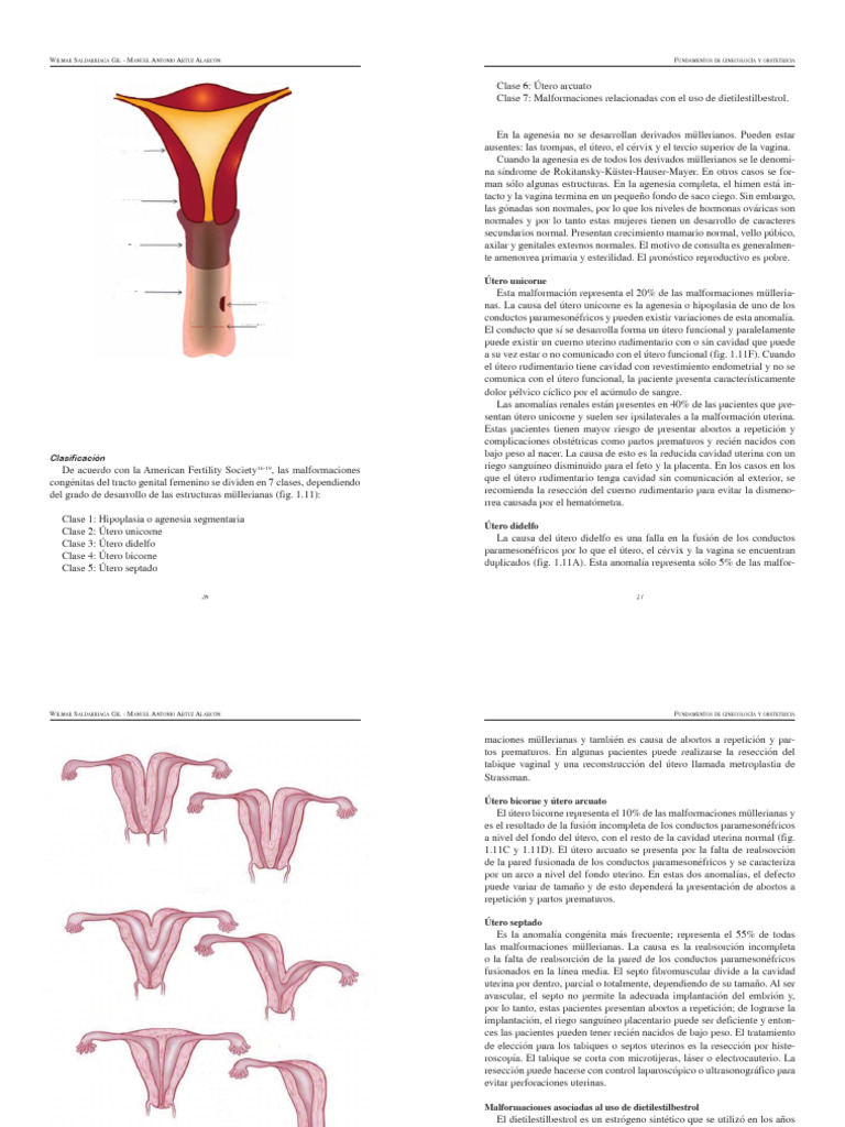 Tipos de Útero | PDF