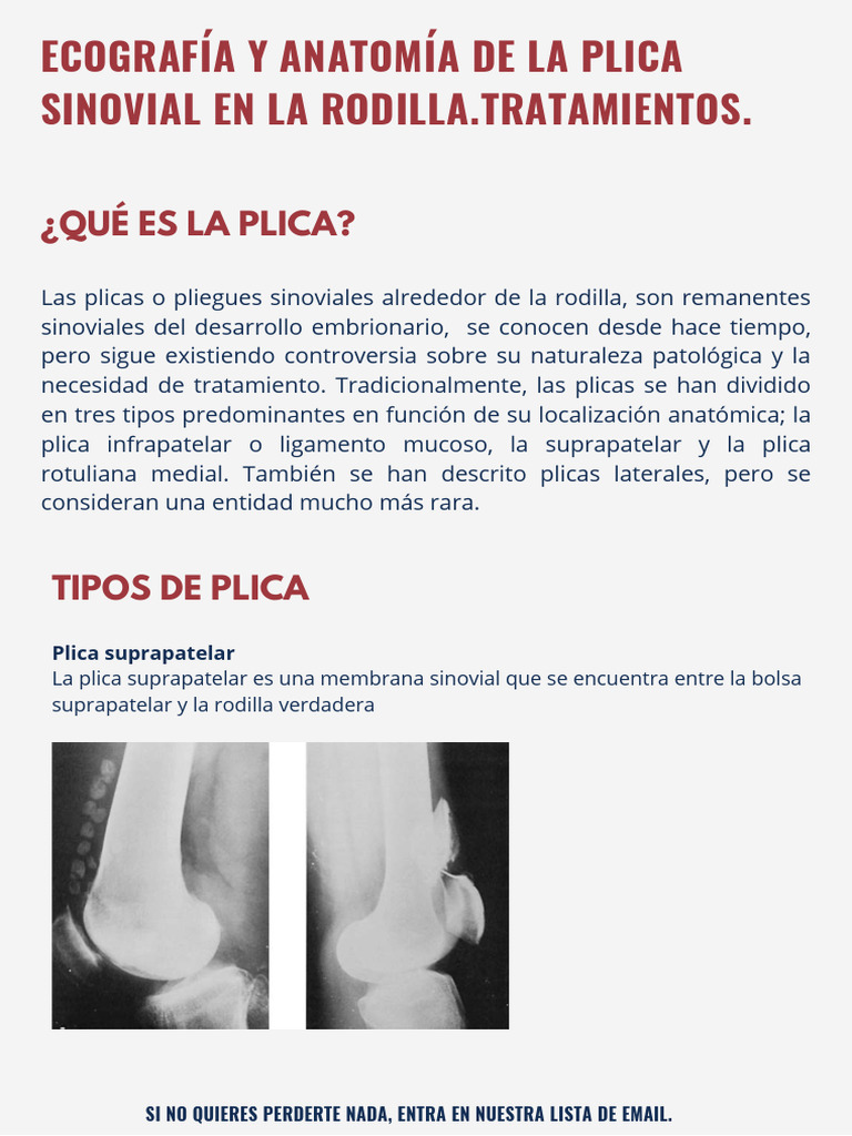 26 Ecografia y Anatomia de La Plica Sinovial | PDF