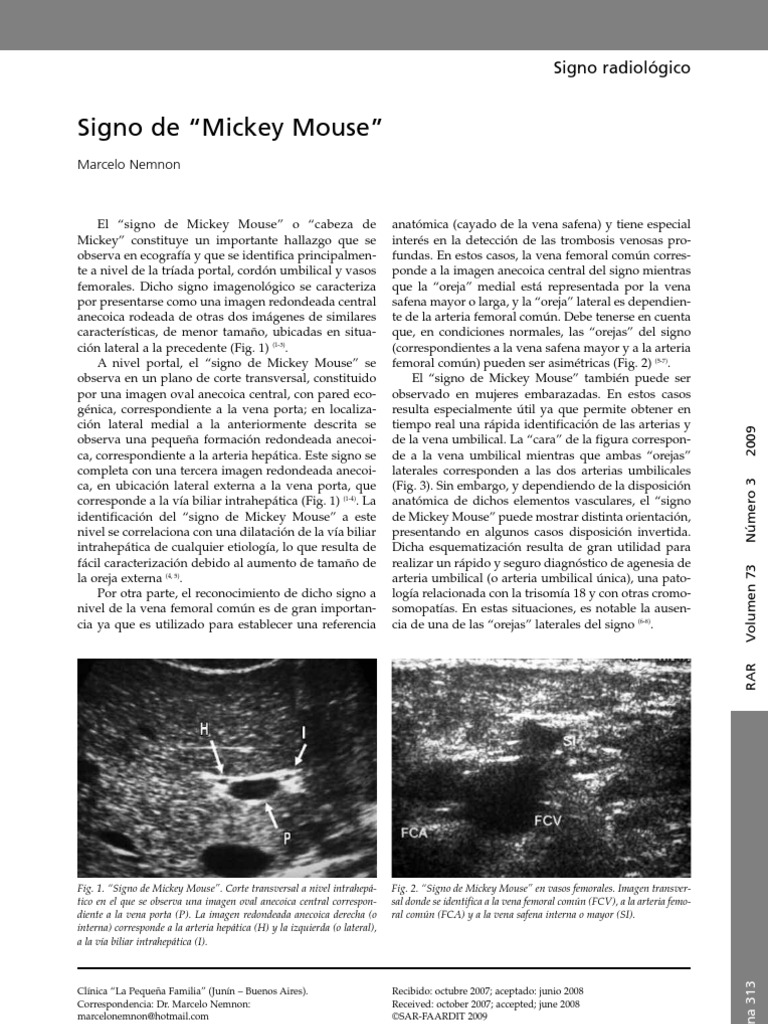 Signo de Mickey Mouse | PDF | Vena | Ultrasonido médico