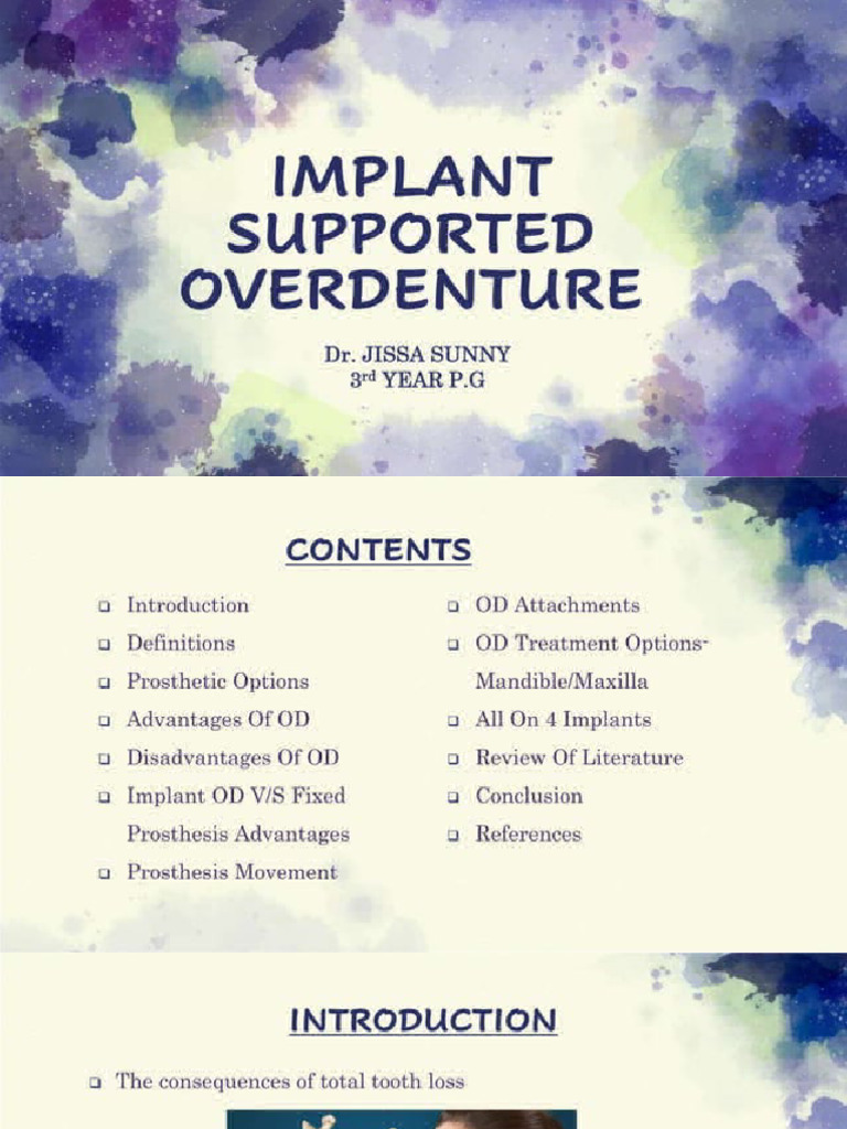 Implant Supported Overdenture | PDF