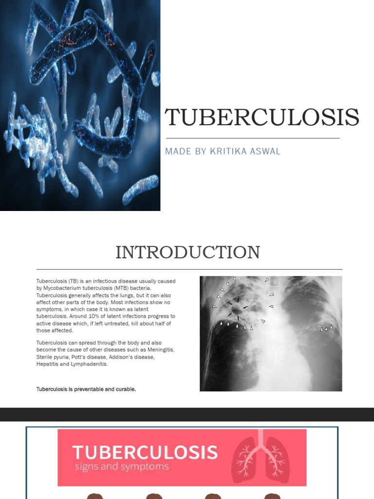 TUBERCULOSIS | PDF