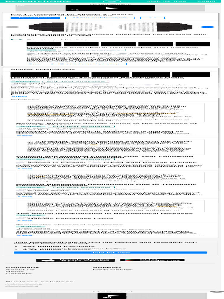 Humphrey Visual Fields Showed Bitemporal Hemianopia With Macular ...