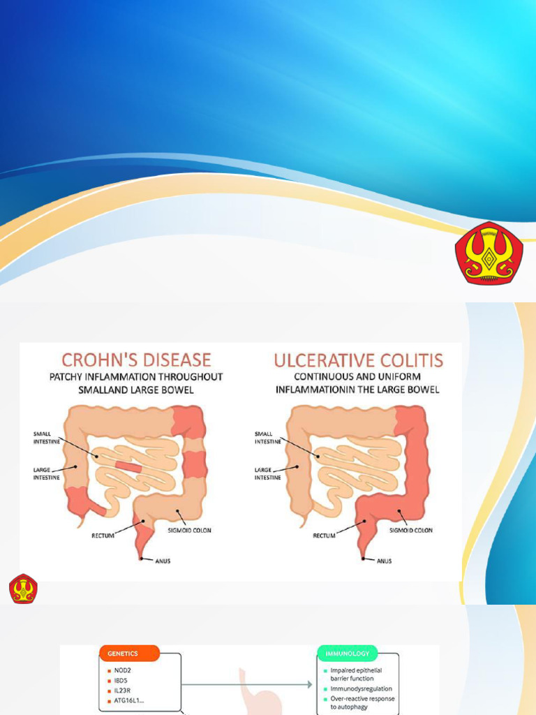IBS Dan IBD Block 8 2022 | PDF