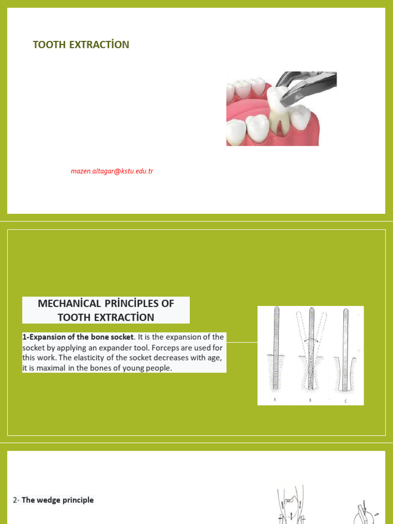 Mechanical Principles of Extraction PDF | PDF