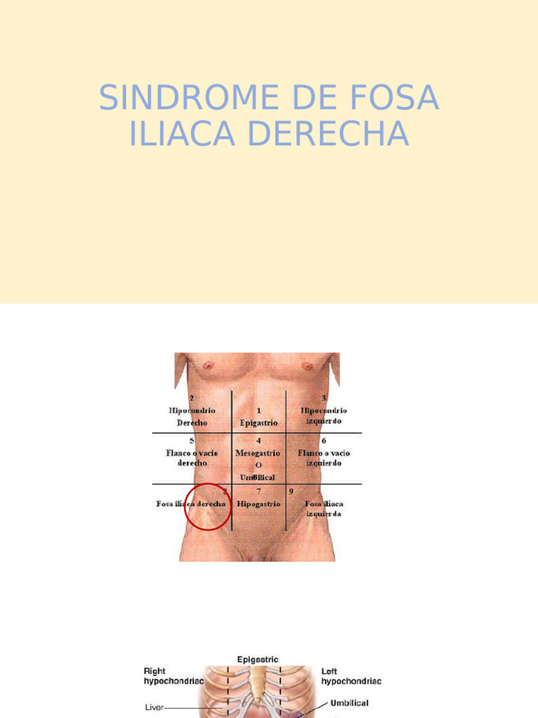 Sindrome de Fosa Iliaca Derecha 2 | PDF