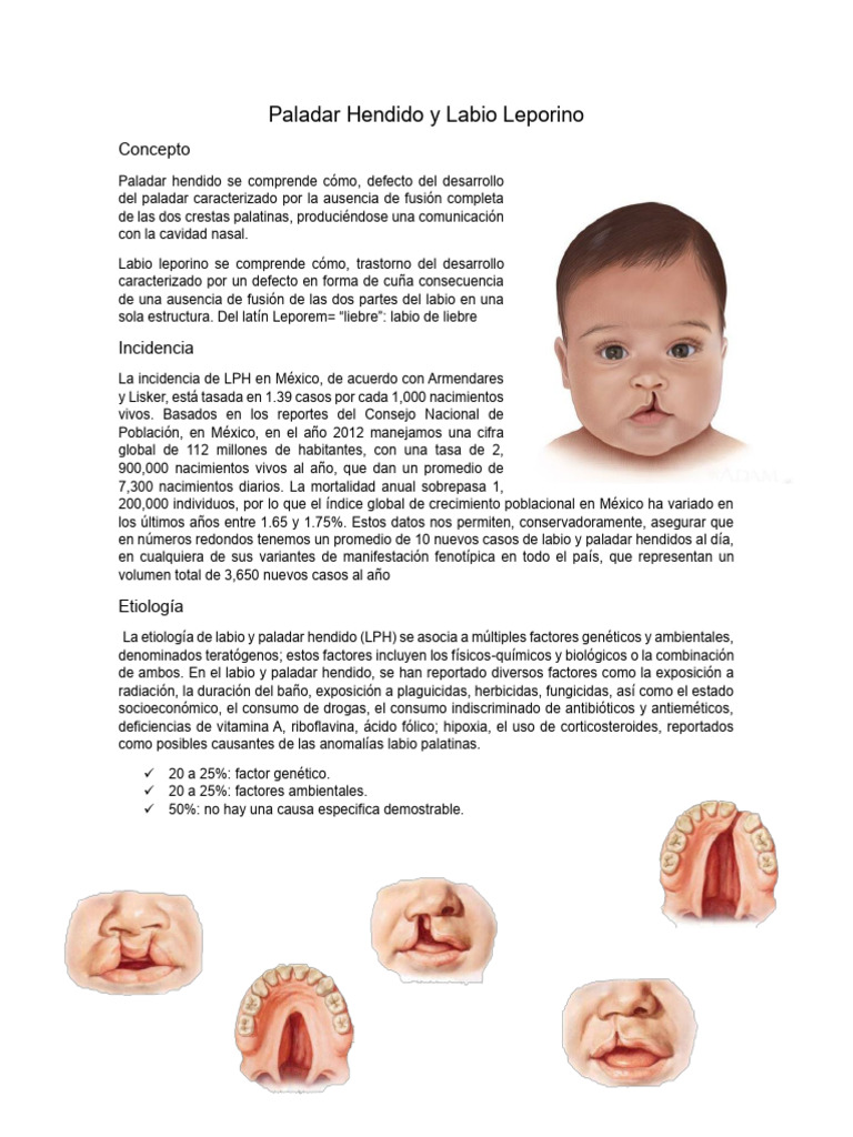 Labio Leporino y Paladar Hendido | PDF