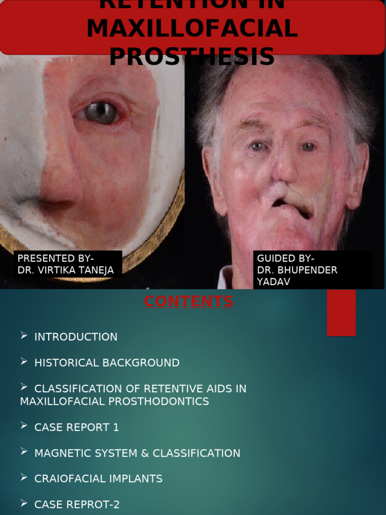 Seminar - Retention of Maxillofacial Prosthesis | PDF