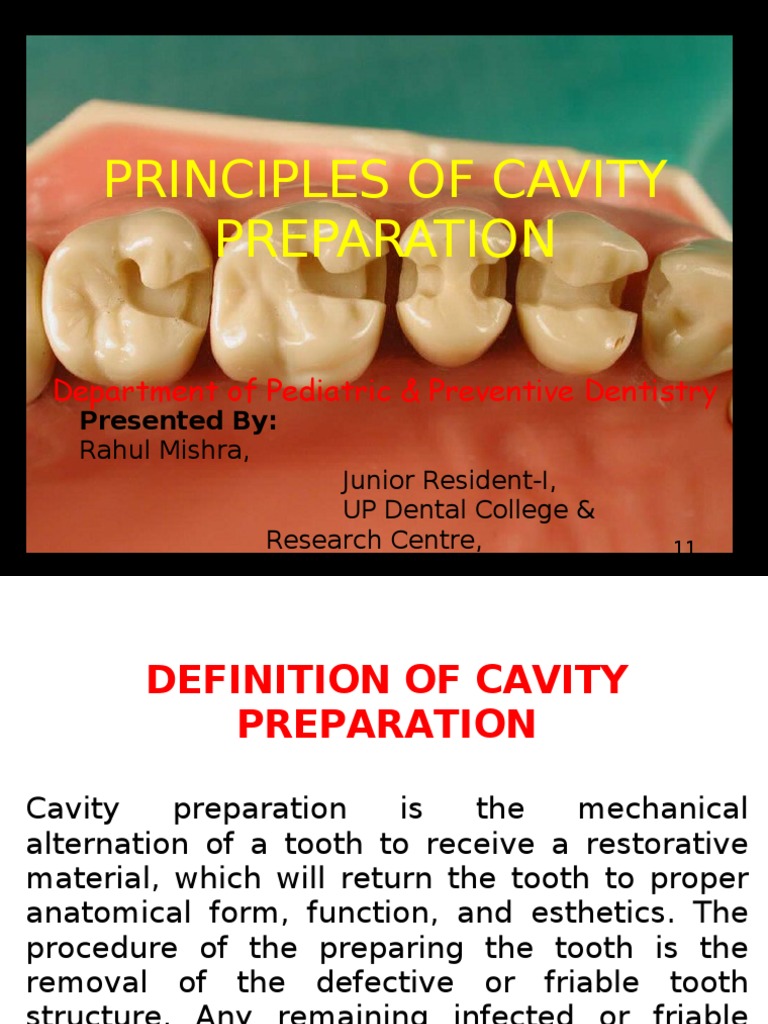 Principles of Cavity Preparation: Department of Pediatric & Preventive ...