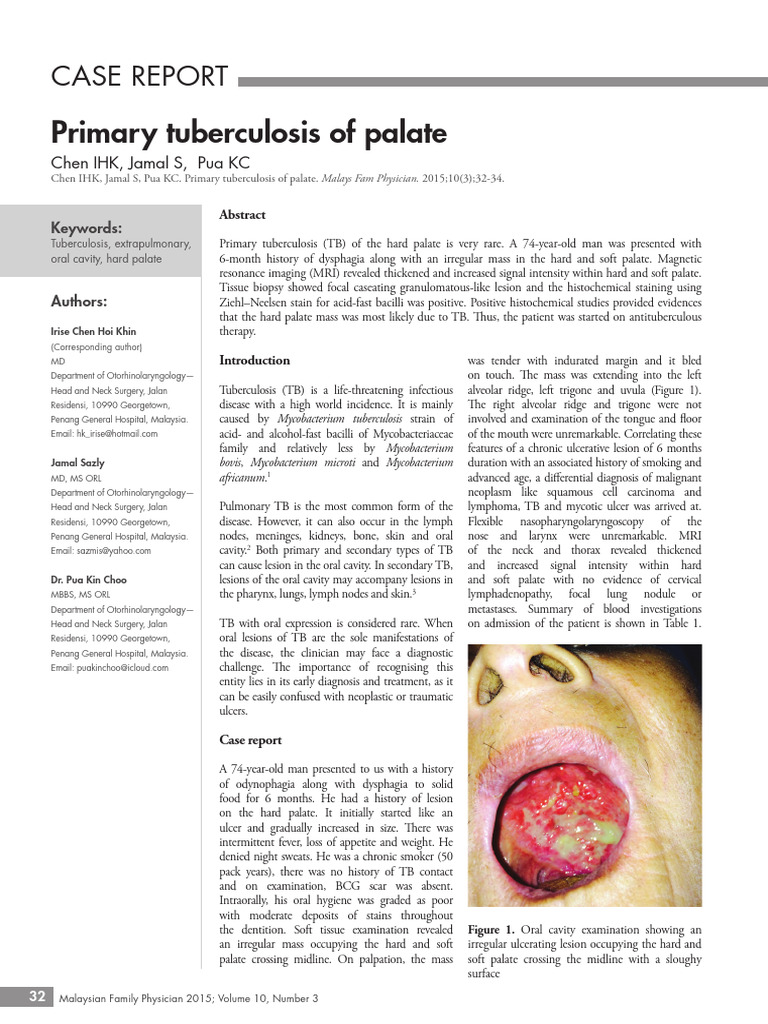 Primary Tuberculosis of the Palate Case Study | PDF | Tuberculosis ...