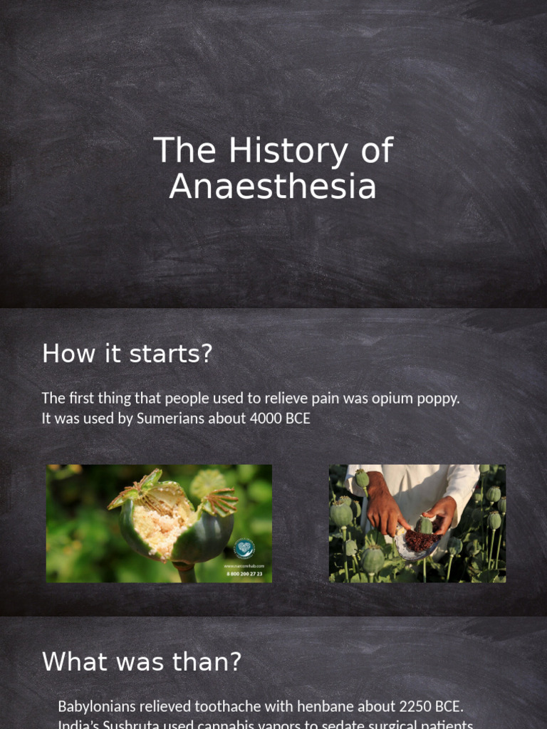 The History of Anaesthesia | PDF