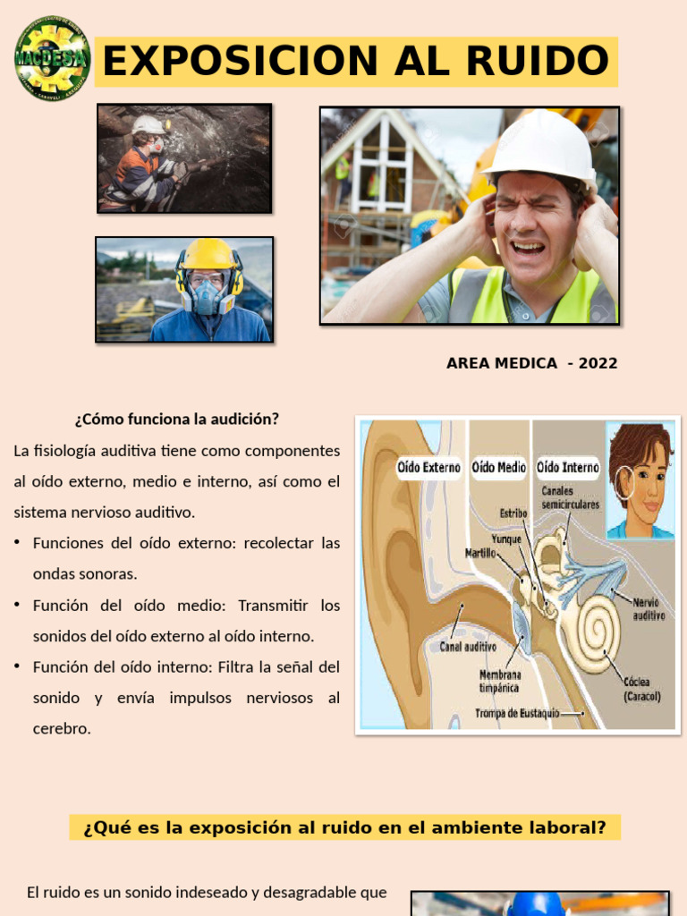 Exposicion Al Ruido | PDF