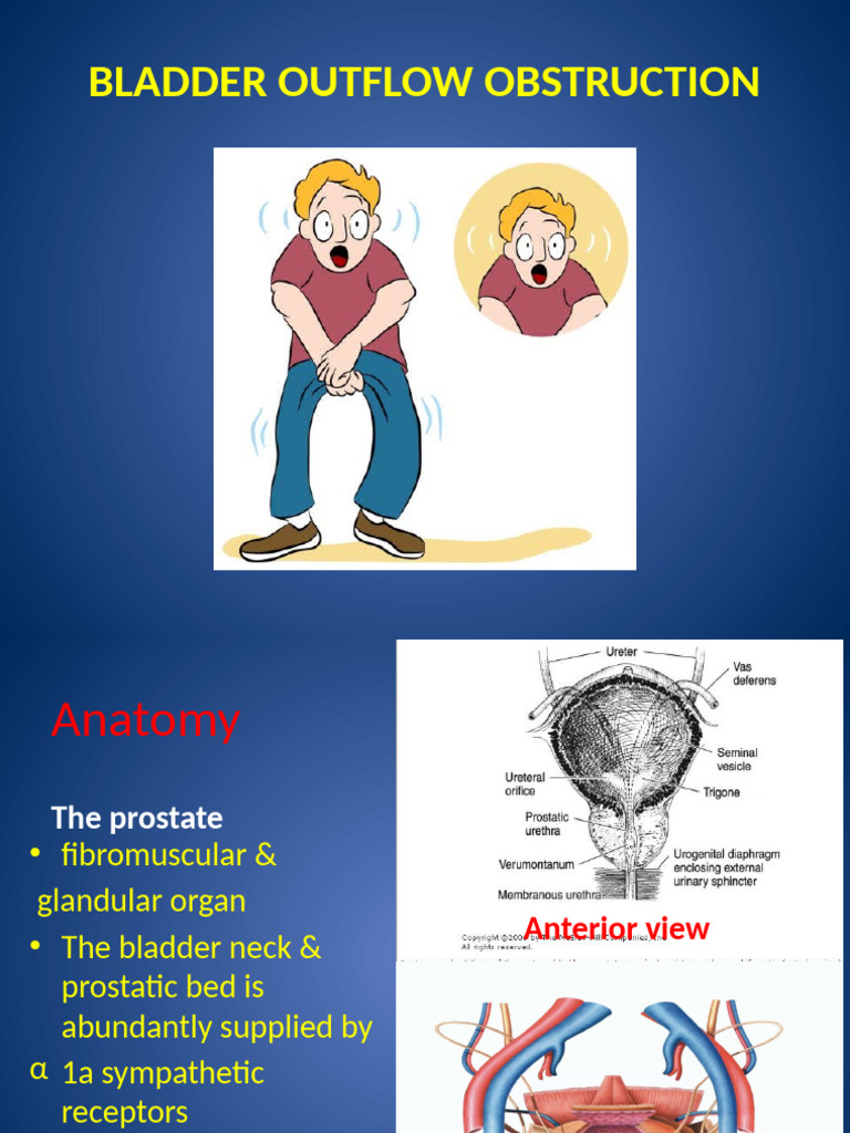 Bladder Outflow Obstructi0n Kims | PDF
