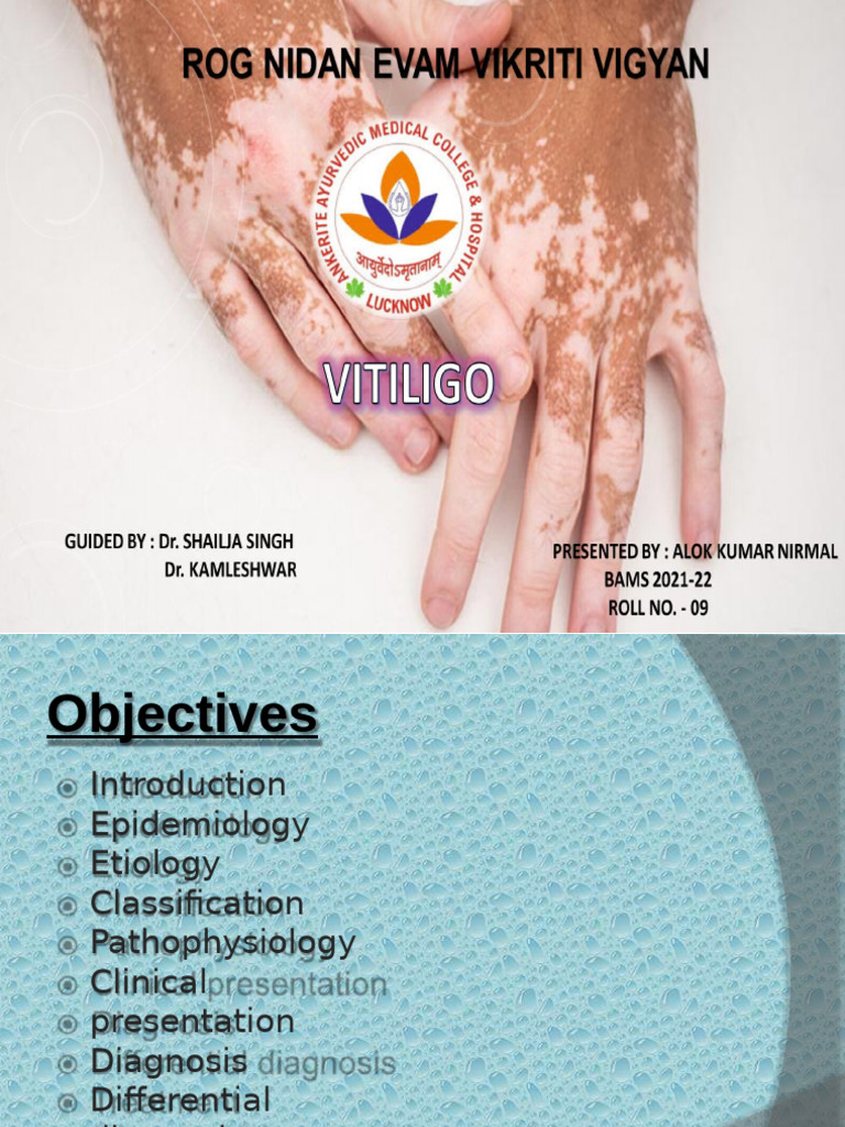 Alok Topic Vitiligo | PDF