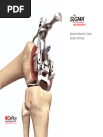 Nexgen Complete Knee Solution Epicondylar Instrumentation Surgical Technique For Legacy ...