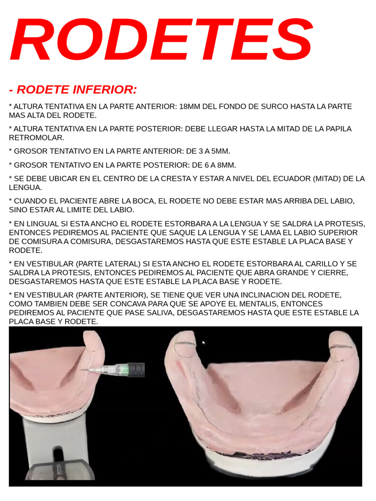 RODETES Tecnica Semcd | PDF