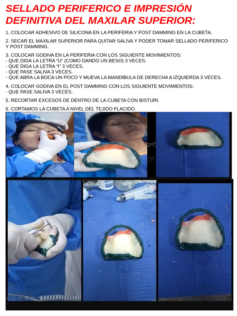 SELLADO PERIFERICO E IMPRESIÓN DEFINITIVA DEL MAXILAR SUPERIOR Tecnica ...