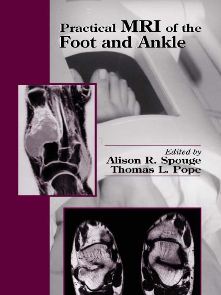 Practical MRI of The Foot and Ankle (Informa, 2000) | PDF | Magnetic ...