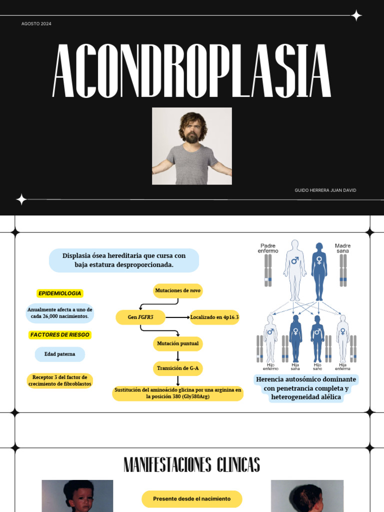 Acondroplasia | PDF