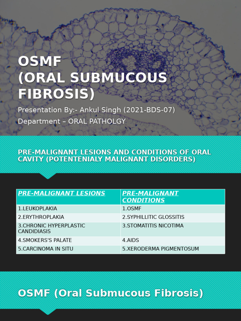 Osmf Ppt Copy New | PDF
