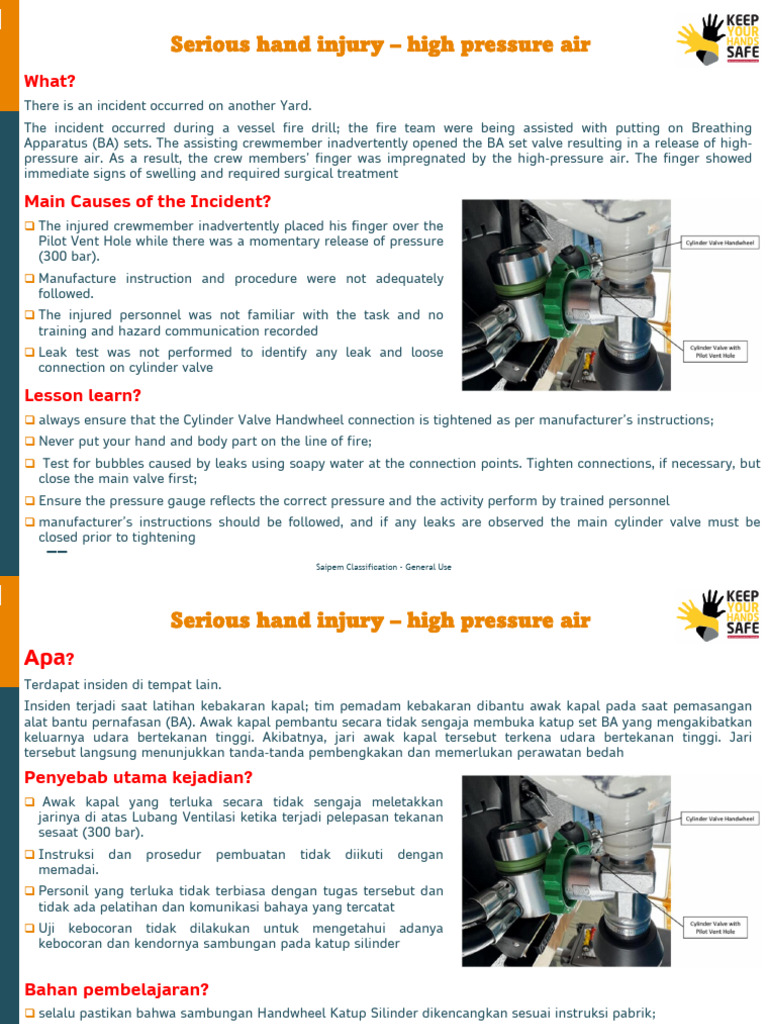 Serious Hand Injury - High Pressure Air | PDF