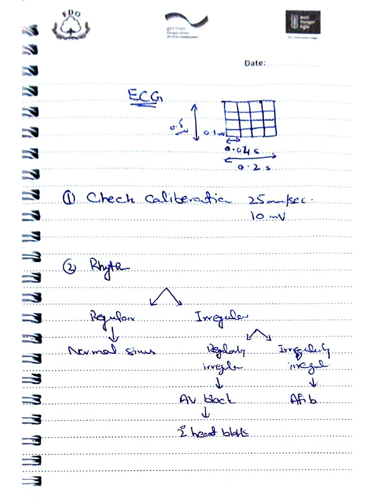 ECG Interpretation-Dr - Muhammad Ans | PDF