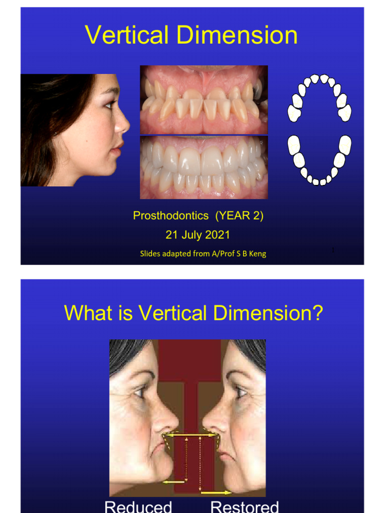 Occlusion 19 Vertical Dimension | PDF
