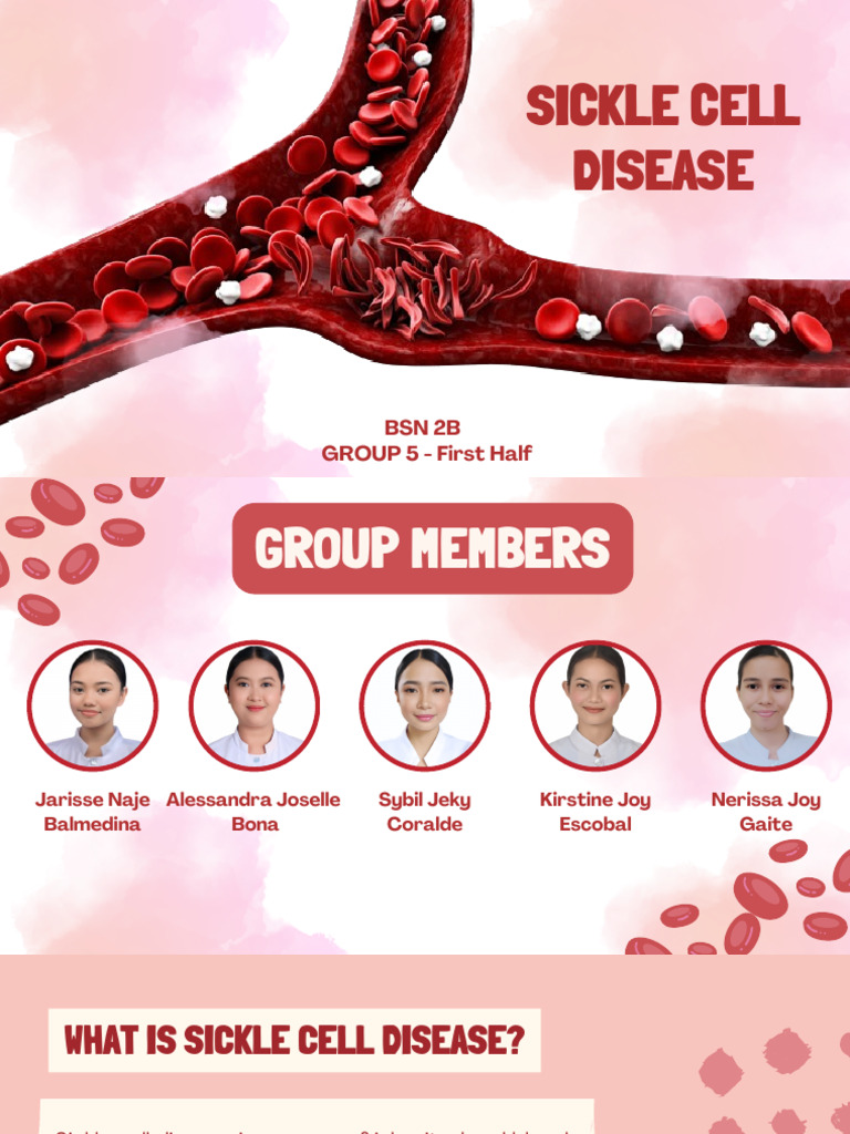 BSN 2B GROUP 5 - Sickle Cell Disease (1st Half) | PDF