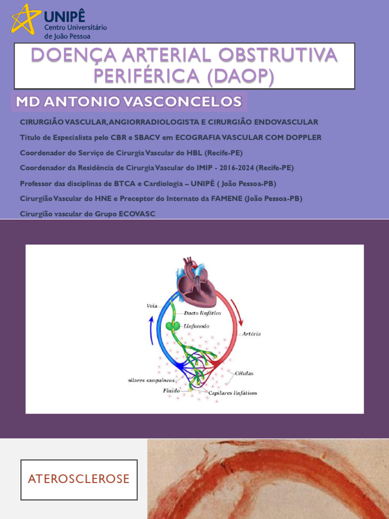 AULA - DAOP - Doença Arterial Obstrutiva Periférica | PDF