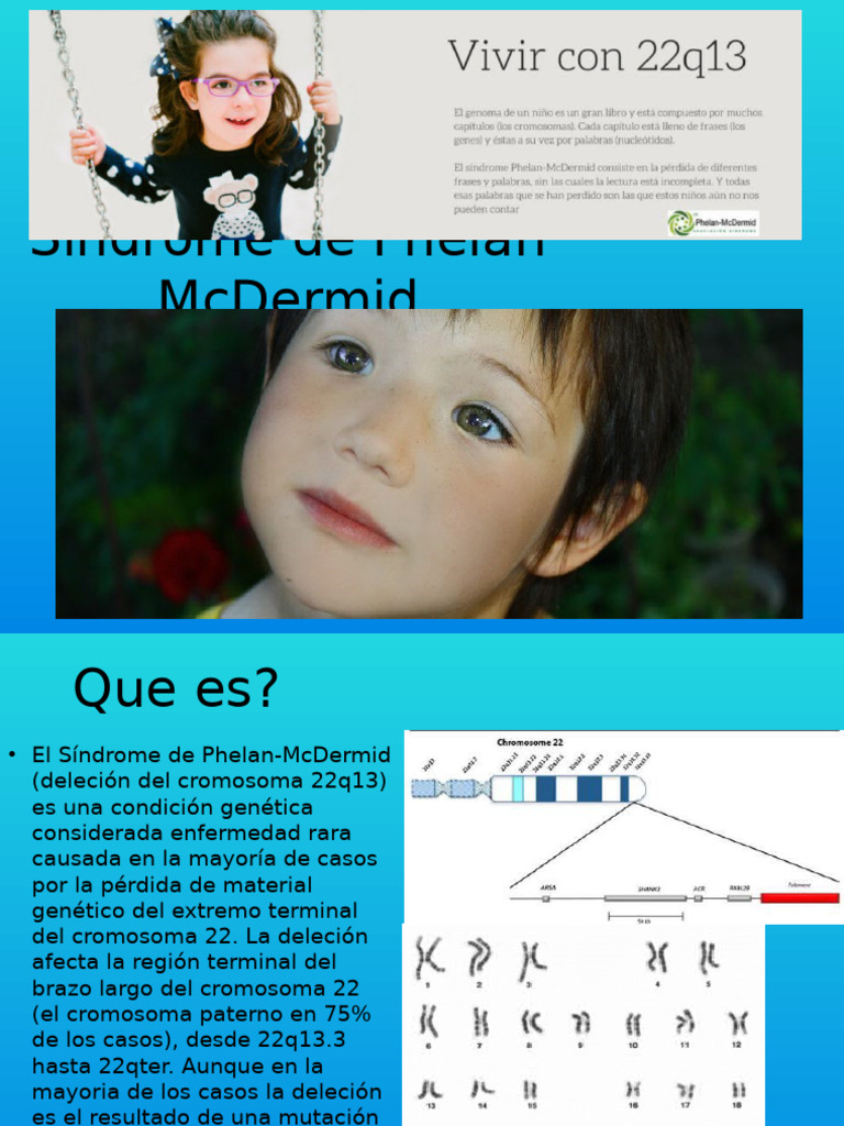 Síndrome de Phelan McDermid | PDF