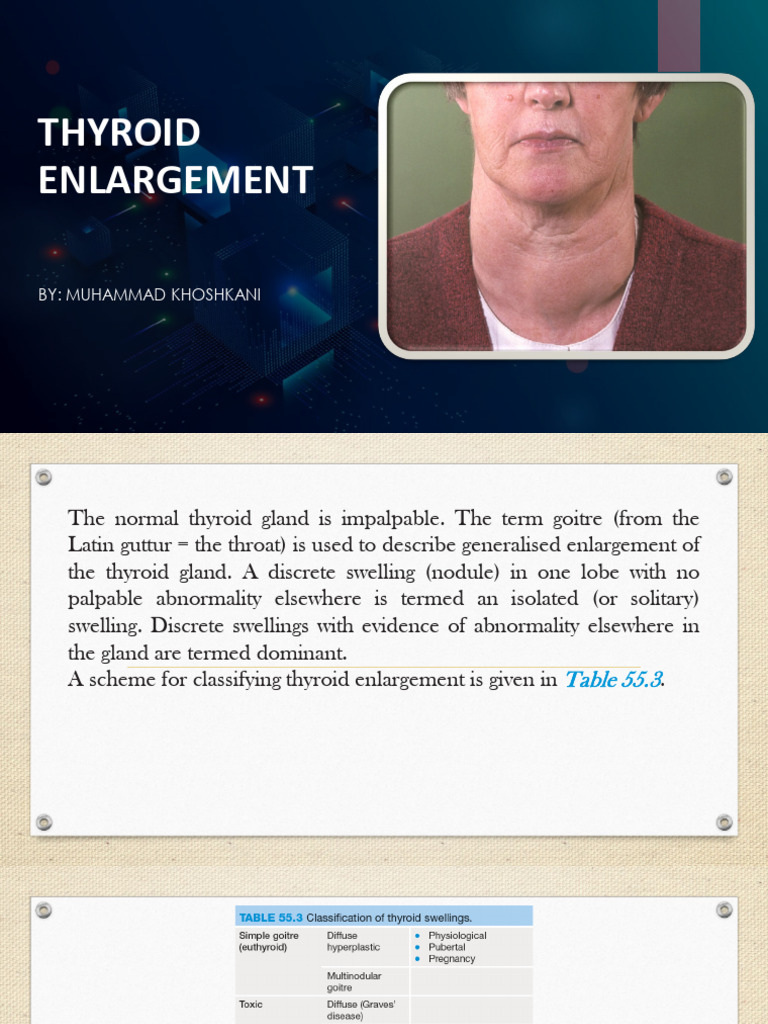 Thyroid Enlargment | PDF