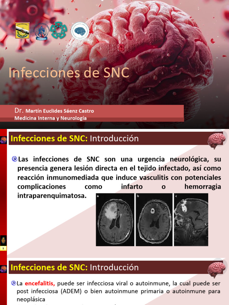 Infecciones de SNC | PDF