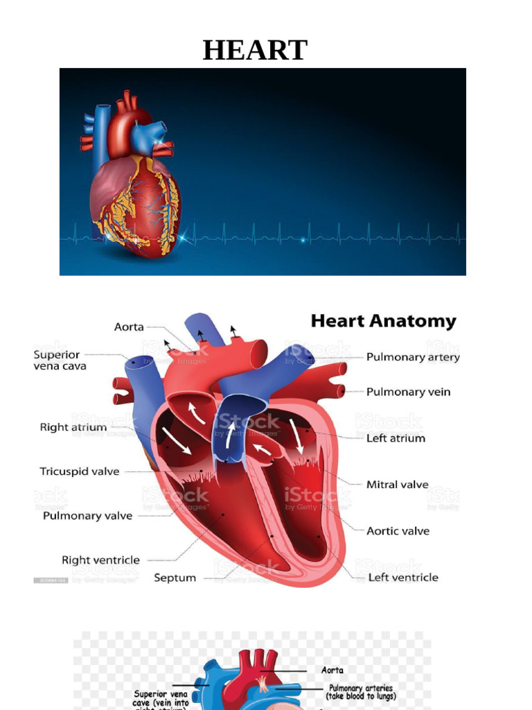 Myocardial Infarction Demo | PDF