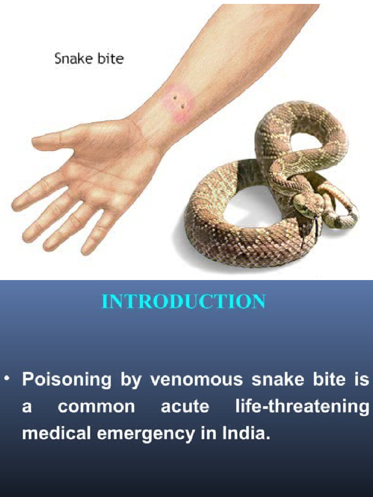 Snake Bite | PDF