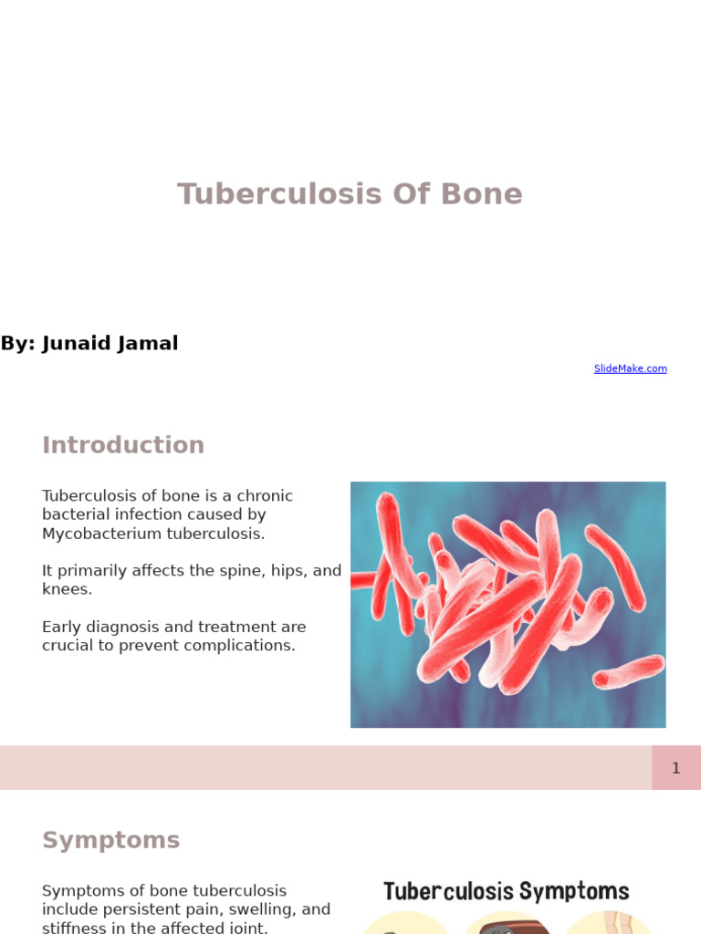 Tuberculosis of Bone | PDF