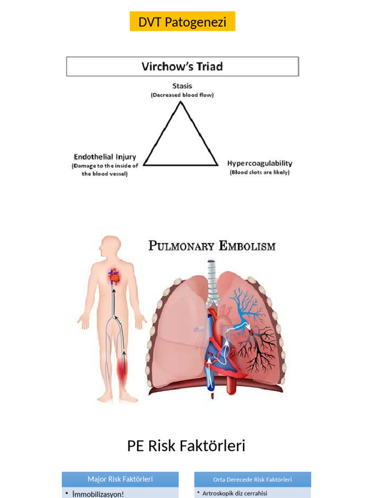 DVT Patogenez | PDF