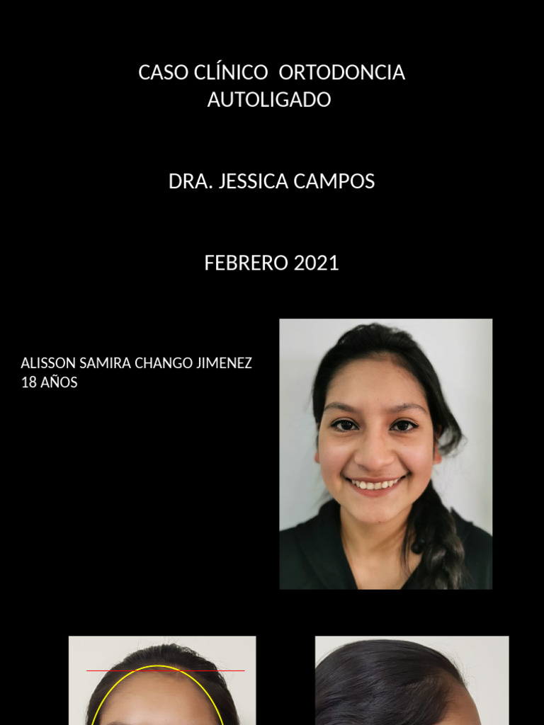caso clinico samira chango(2) | PDF