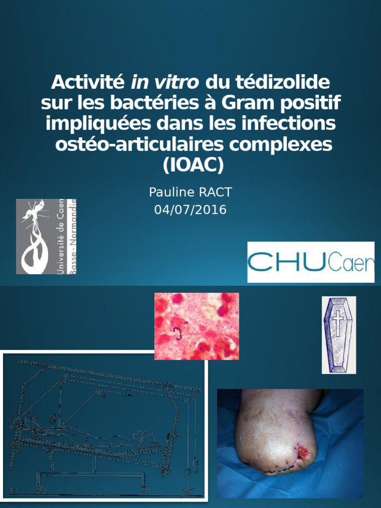 Tédizolide contre bactéries Gram positif | PDF | Pénicilline | Streptocoque