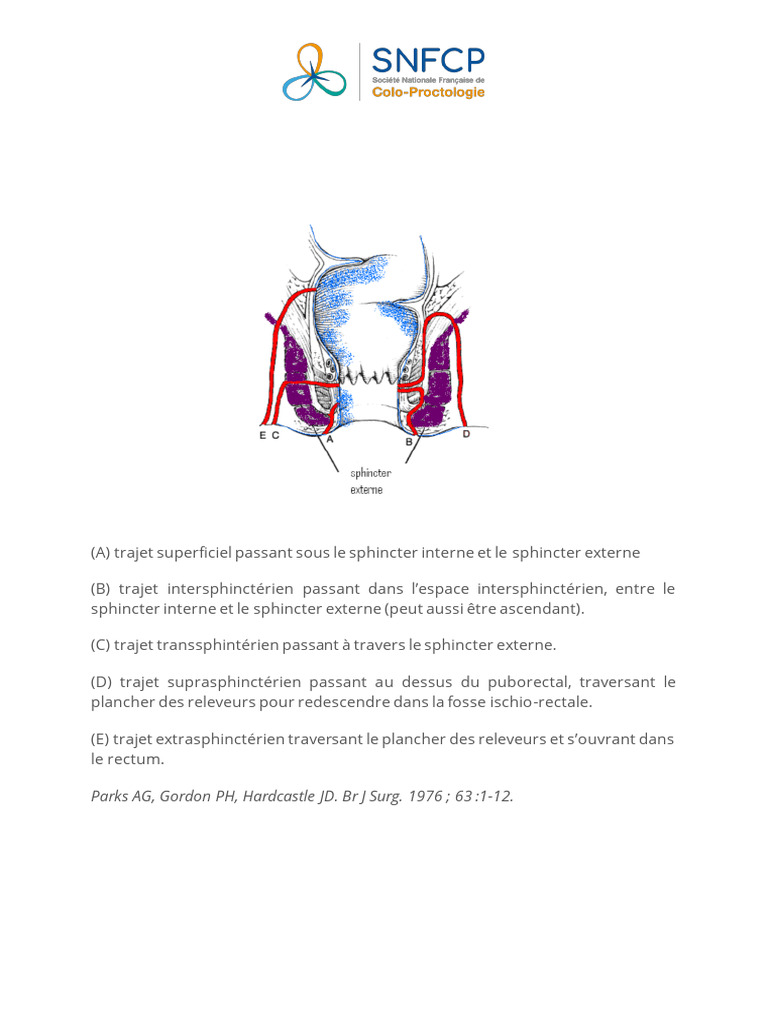 Fistules Anales Classification de Parks | PDF