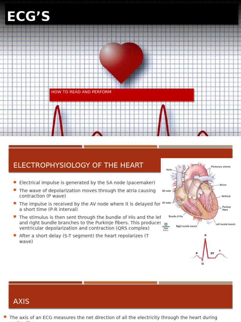 ECG's | PDF