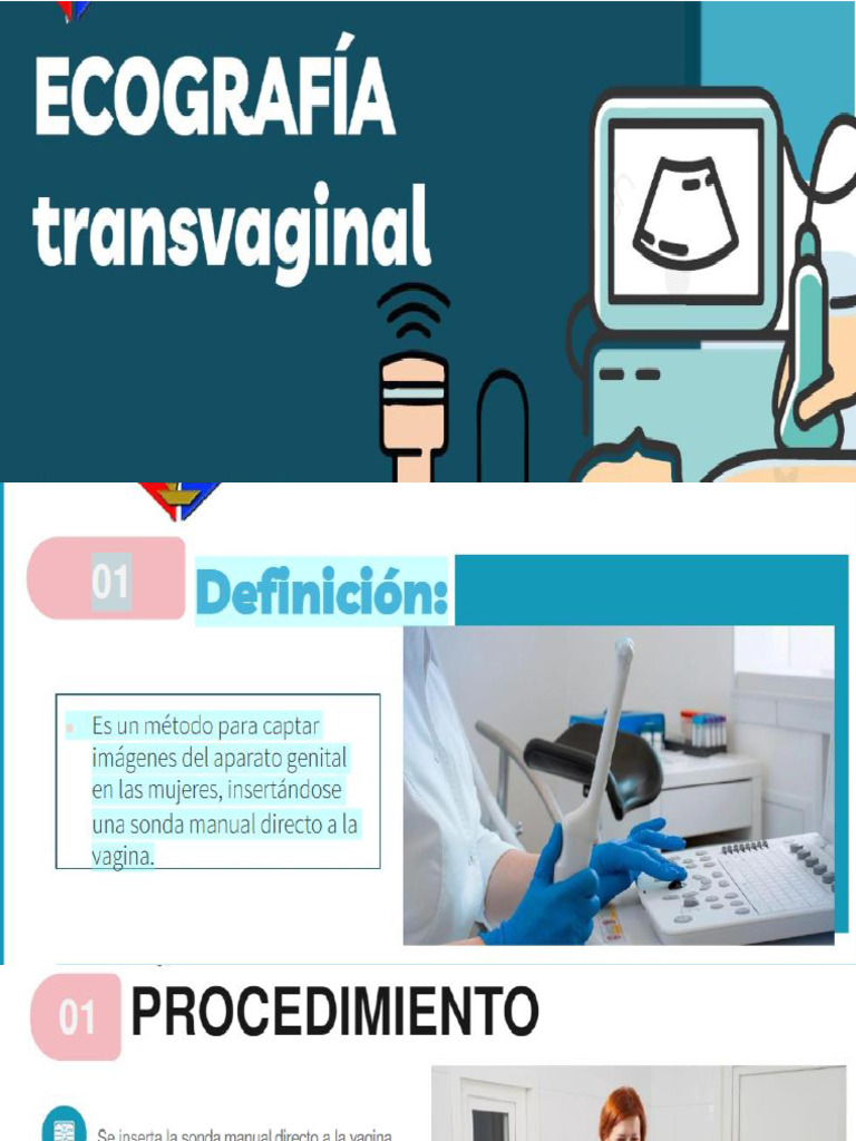 Transvaginal Tef | PDF