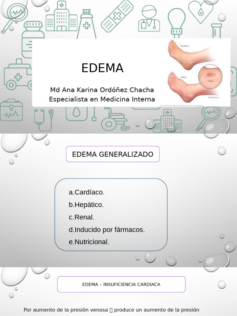 Edema 2 | PDF