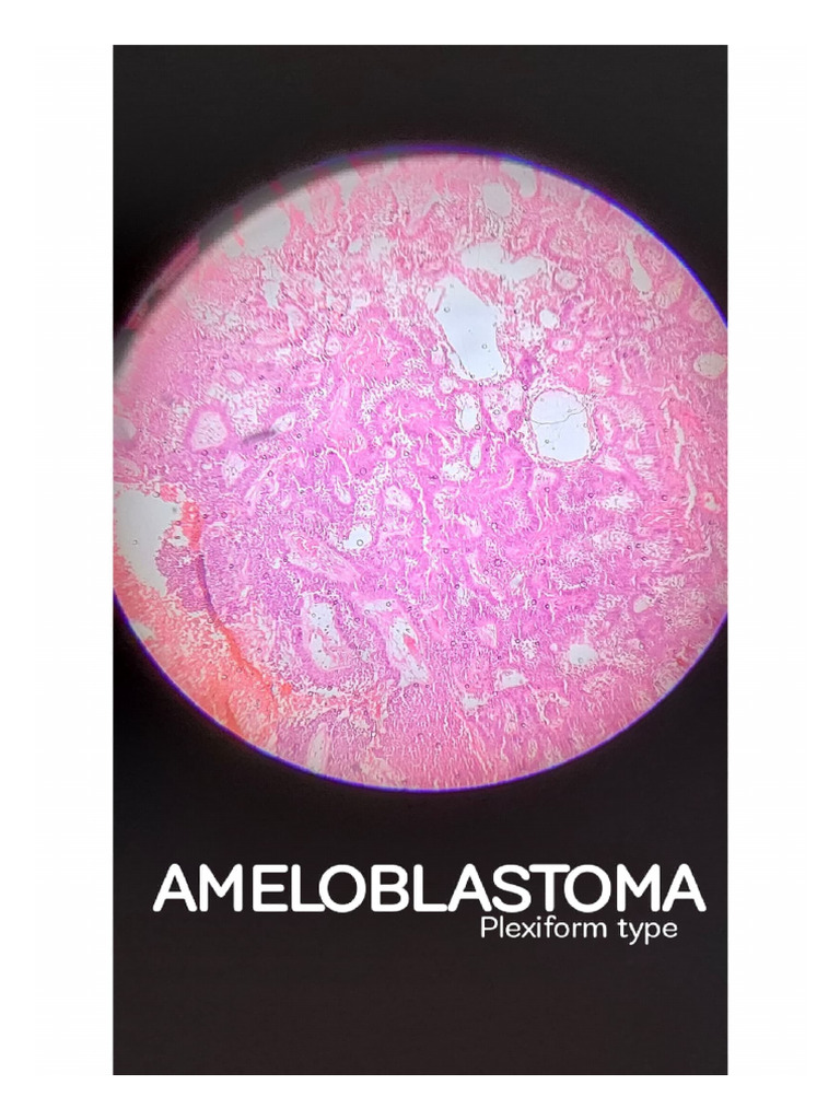 Oral Pathology - SLIDES | PDF