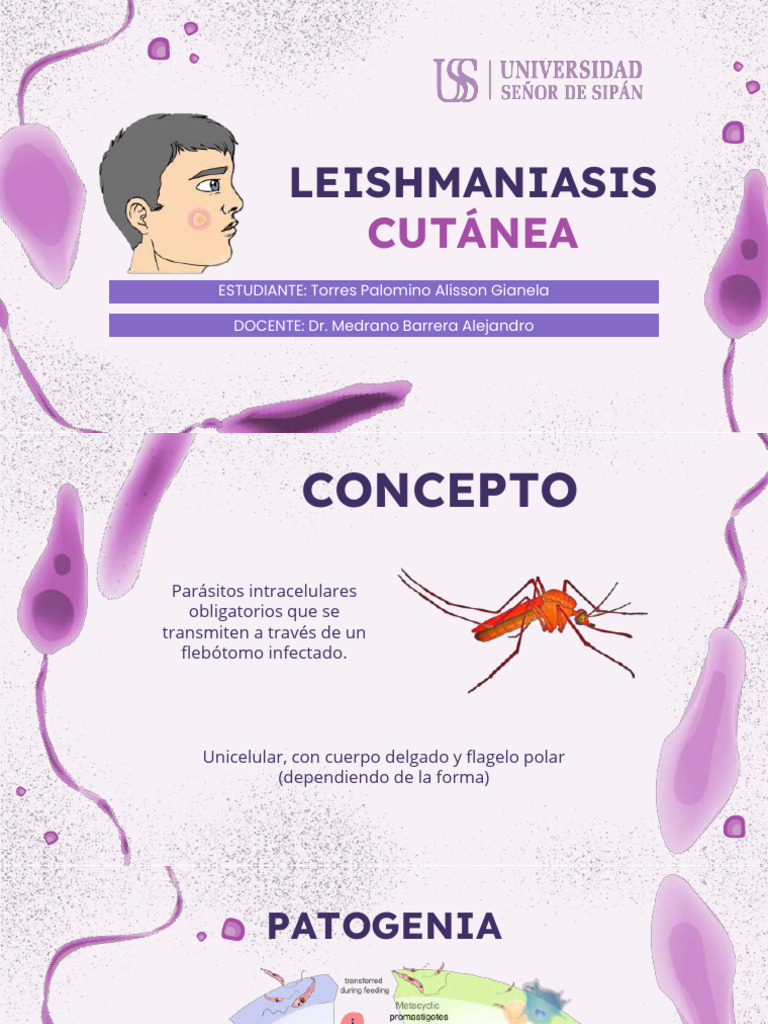 Leishmaniasis - Alisson Torres | PDF