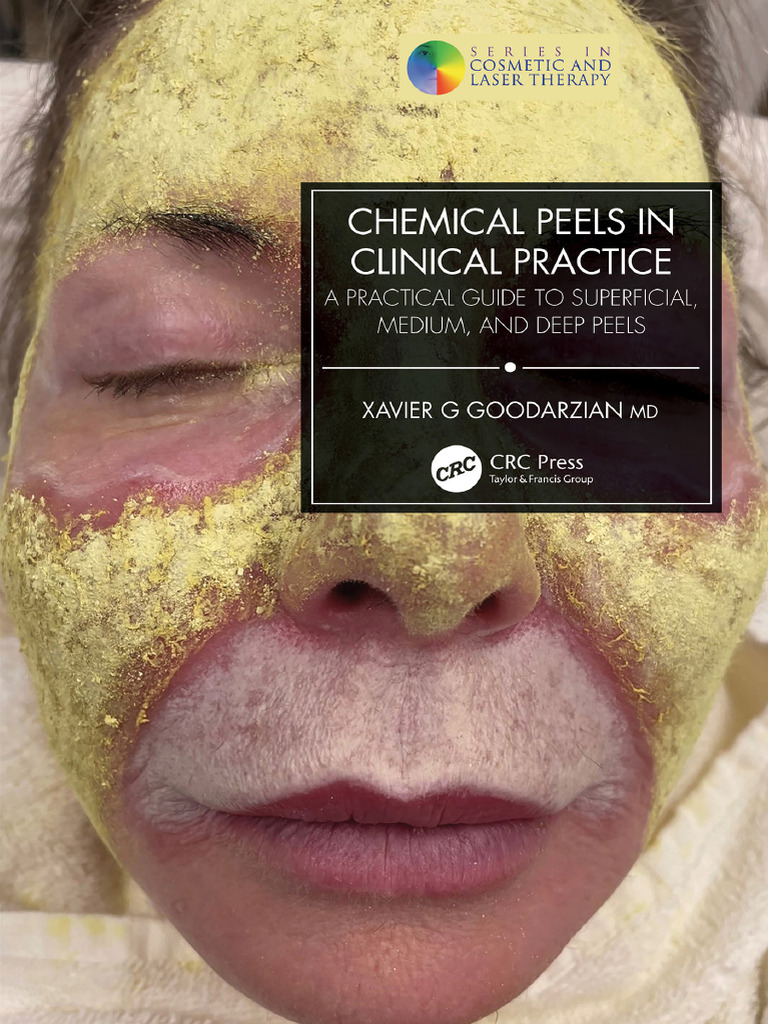 Chemical Peels in Clinical Practice - A Practical Guide To Superficial ...